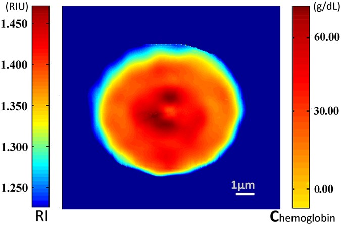 Quantitative refractive index distribution of single cell by combining ...