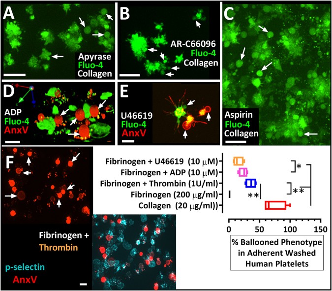 Membrane Ballooning in Aggregated Platelets is Synchronised and ...