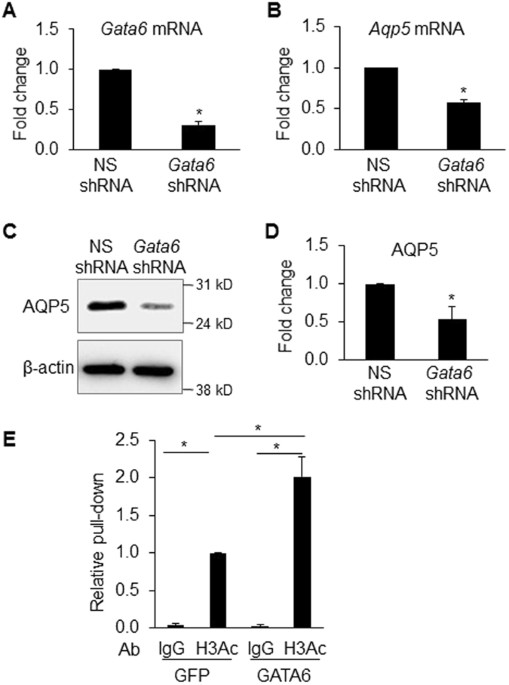 Cell-specific expression of aquaporin-5 ( Aqp5 ) in alveolar epithelium ...