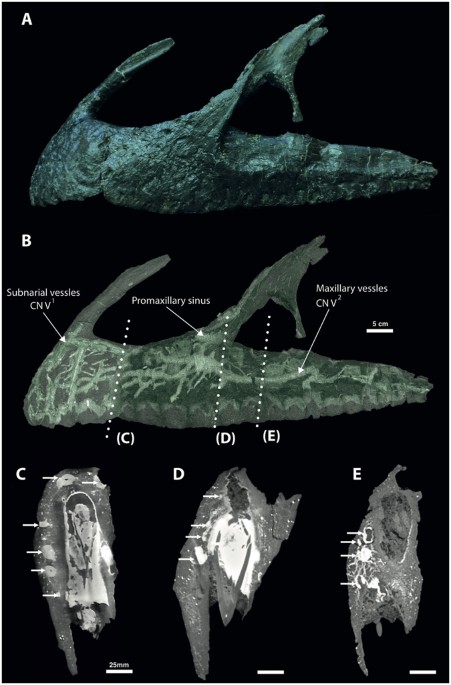 Complex neuroanatomy in the rostrum of the Isle of Wight theropod ...