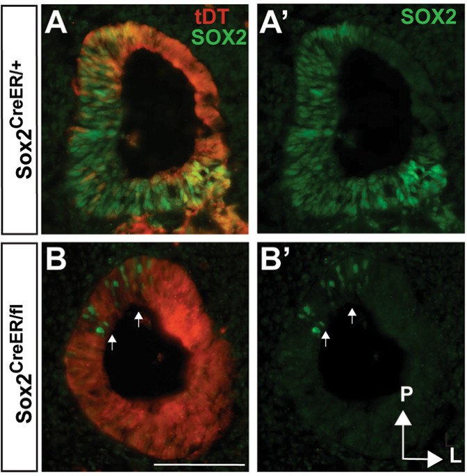 SOX2 is required for inner ear neurogenesis | Scientific Reports