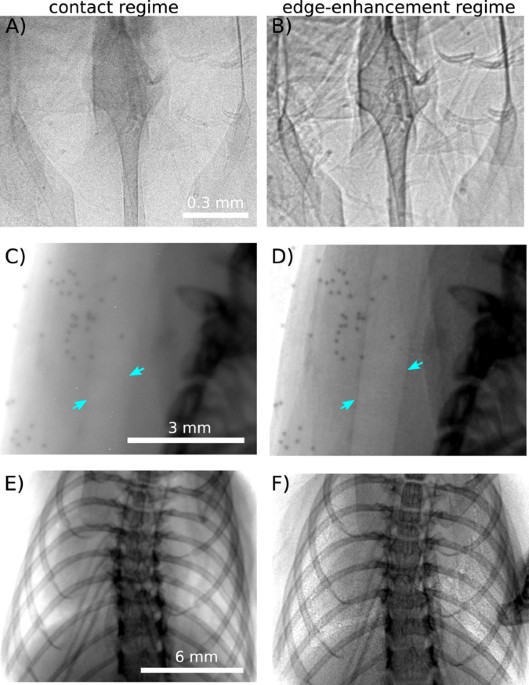 Propagation-based Phase-Contrast X-ray Imaging at a Compact Light ...