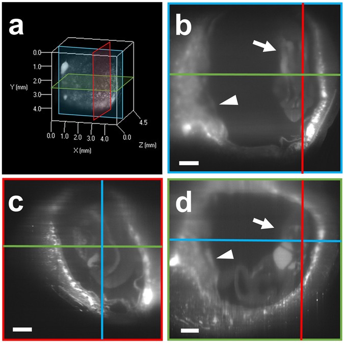 Three-dimensional visualization of intrauterine conceptus through the ...