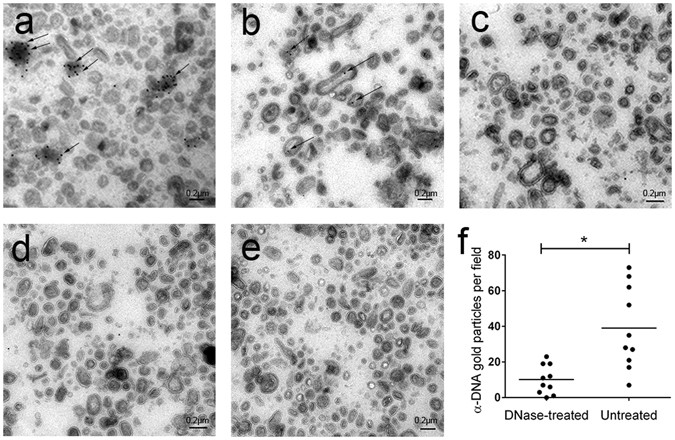 Bacterial membrane vesicles transport their DNA cargo into host cells ...