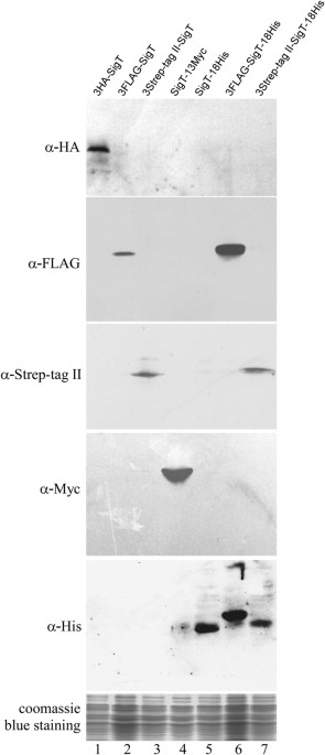 Development of Series of Affinity Tags in Streptomyces | Scientific Reports