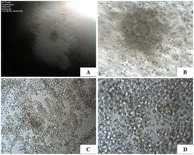 Effect of GOLPH3 on cumulus granulosa cell apoptosis and ICSI pregnancy ...