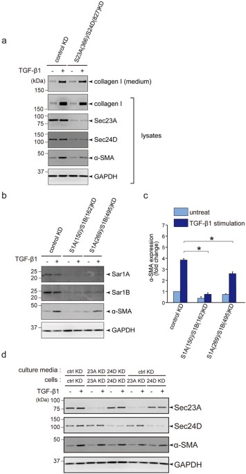 CREB3L2-mediated expression of Sec23A/Sec24D is involved in hepatic ...