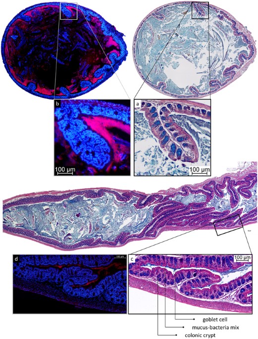 Mucus organisation is shaped by colonic content; a new view ...
