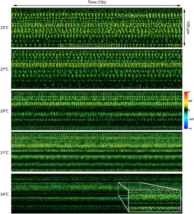 Visualization and Detection of Ciliary Beating Pattern and Frequency in the Upper Airway using ...