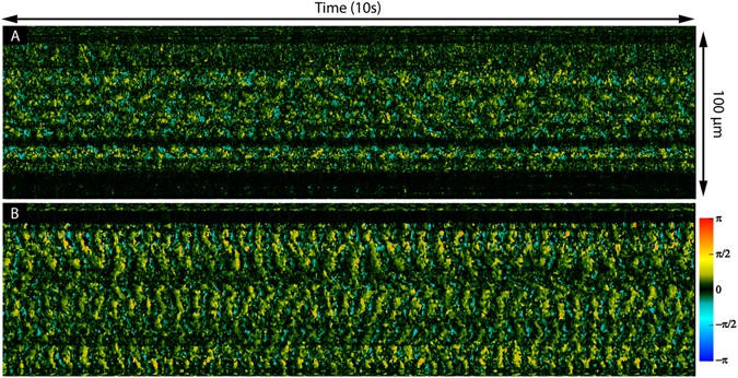 Visualization and Detection of Ciliary Beating Pattern and Frequency in the Upper Airway using ...