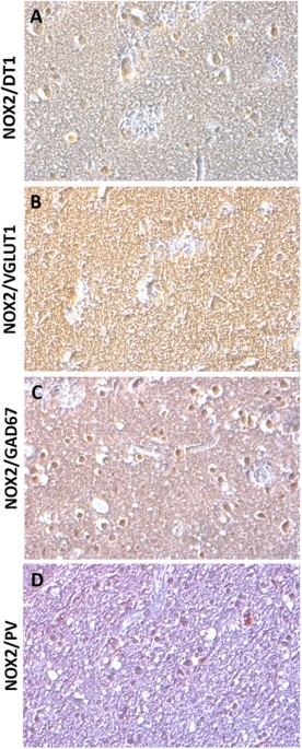 The NADPH oxidase NOX2 mediates loss of parvalbumin interneurons in ...