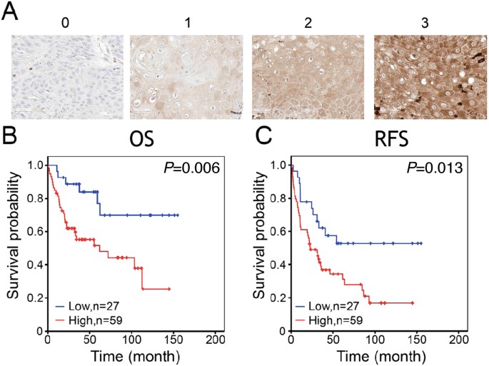 Global Proteomics-based Identification and Validation of Thymosin Beta ...