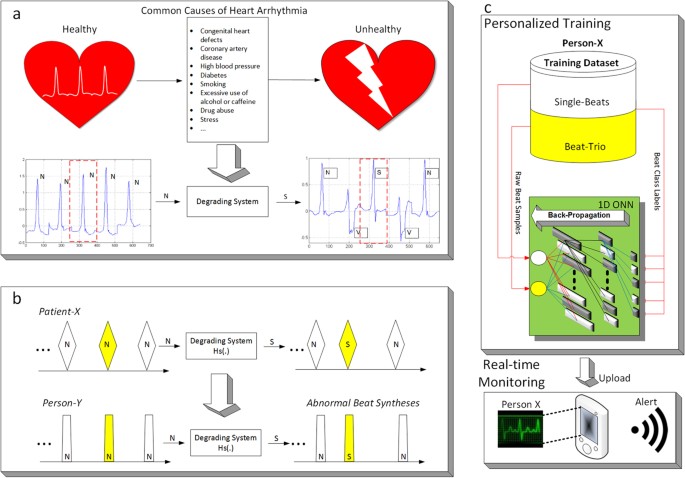 Personalized Monitoring and Advance Warning System for Cardiac ...