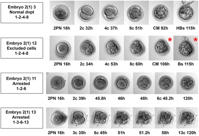 Tripolar mitosis and partitioning of the genome arrests human ...