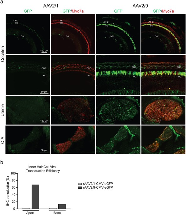 Intravenous rAAV2/9 injection for murine cochlear gene delivery ...