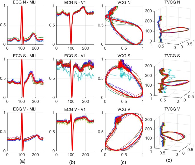 Inter-Patient ECG Heartbeat Classification with Temporal VCG Optimized by PSO | Scientific Reports