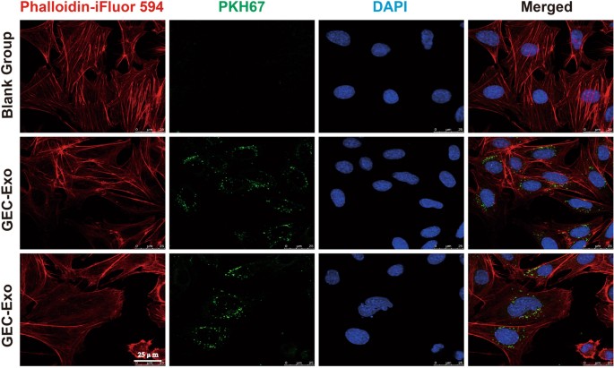 Exosomes from high glucose-treated glomerular endothelial cells trigger ...