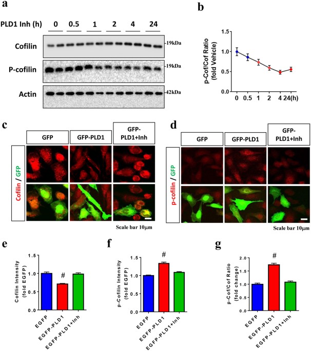 Cofilin-mediated Neuronal Apoptosis via p53 Translocation and PLD1 ...