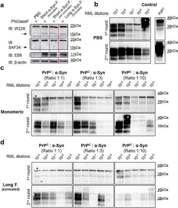 α-Synuclein Amyloids Hijack Prion Protein to Gain Cell Entry, Facilitate Cell-to-Cell Spreading ...