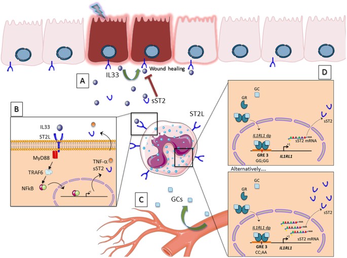 A functional IL1RL1 variant regulates corticosteroid-induced sST2 ...