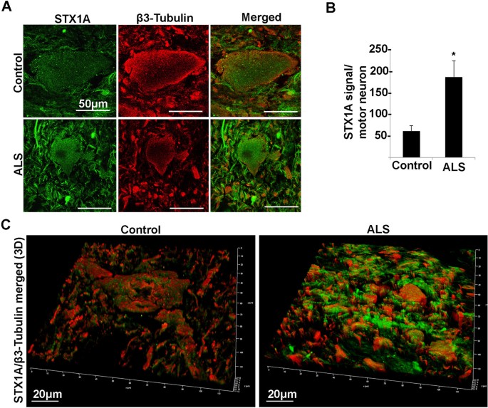 Massive transcriptome sequencing of human spinal cord tissues provides ...