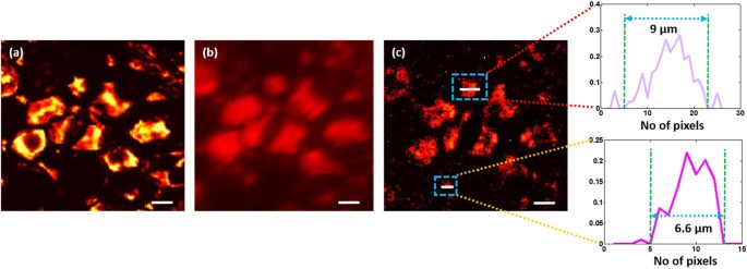 Scatter-plate microscope for lensless microscopy with diffraction ...