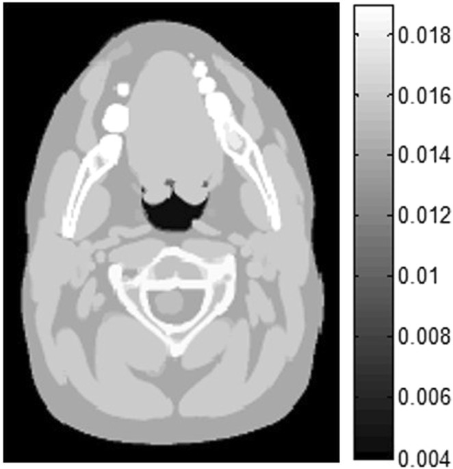 An improved statistical iterative algorithm for sparse-view and limited-angle CT image ...