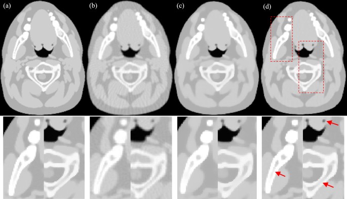 An Improved Statistical Iterative Algorithm For Sparse View And Limited Angle Ct Image