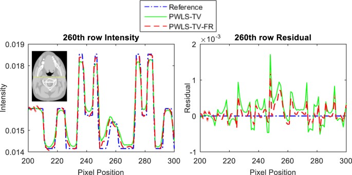 An improved statistical iterative algorithm for sparse-view and limited-angle CT image ...