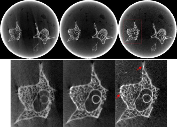 An improved statistical iterative algorithm for sparse-view and limited-angle CT image ...
