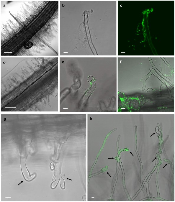 Monitoring the colonization and infection of legume nodules by ...