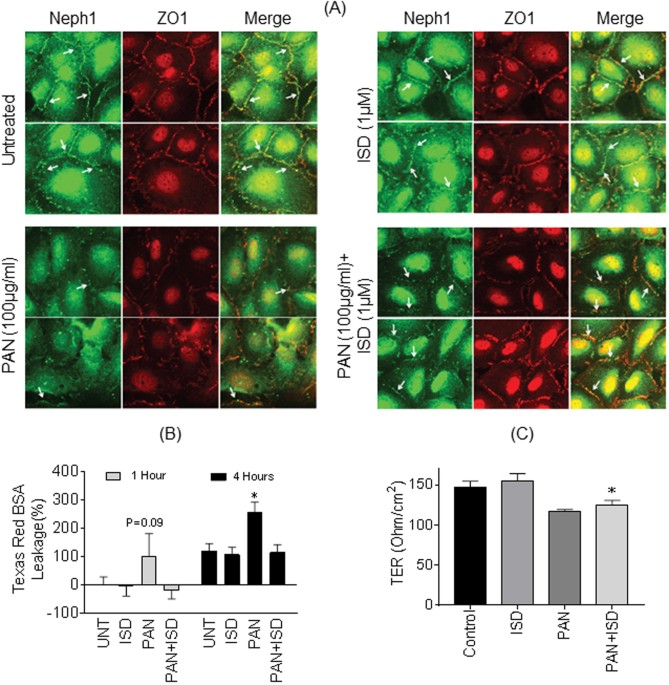 Targeting Neph1 and ZO-1 protein-protein interaction in podocytes ...