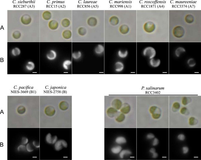 Chloropicophyceae, a new class of picophytoplanktonic prasinophytes ...