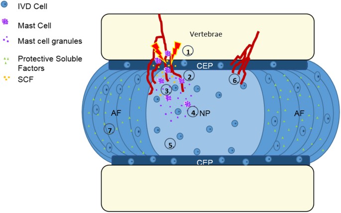 Mast Cell-Intervertebral disc cell interactions regulate inflammation ...