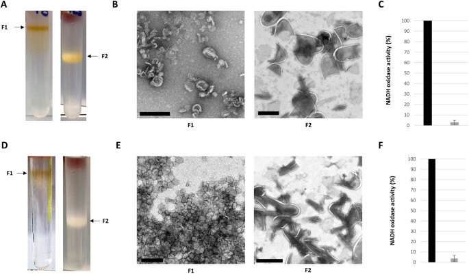 Dissecting the mycobacterial cell envelope and defining the composition of the native ...