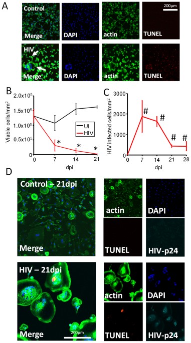 HIV-infected macrophages and microglia that survive acute infection ...