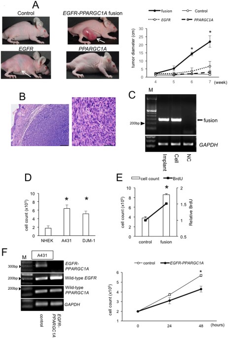 Chronic sun exposure-related fusion oncogenes EGFR-PPARGC1A in ...