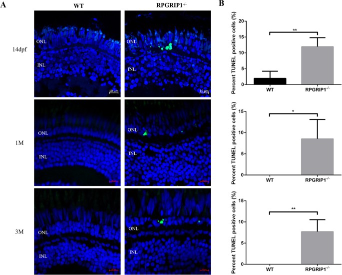 Rpgrip1 is required for rod outer segment development and ciliary ...