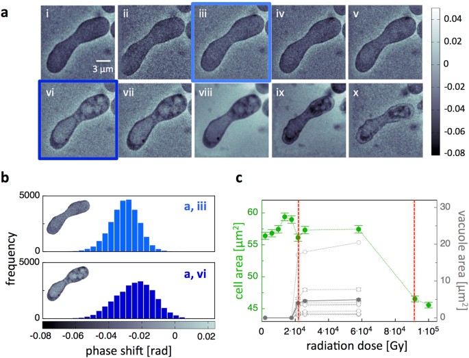 Live cell X-ray imaging of autophagic vacuoles formation and chromatin ...
