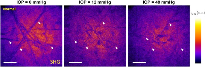 Stromal striae: a new insight into corneal physiology and mechanics ...