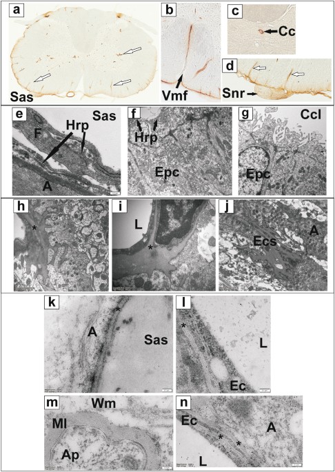 The ultrastructure of spinal cord perivascular spaces: Implications for ...