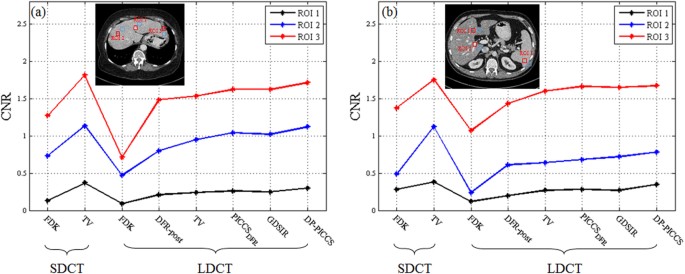 Discriminative Prior - Prior Image Constrained Compressed Sensing ...