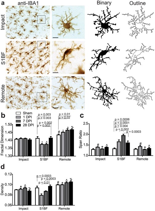 Quantitative microglia analyses reveal diverse morphologic responses in ...