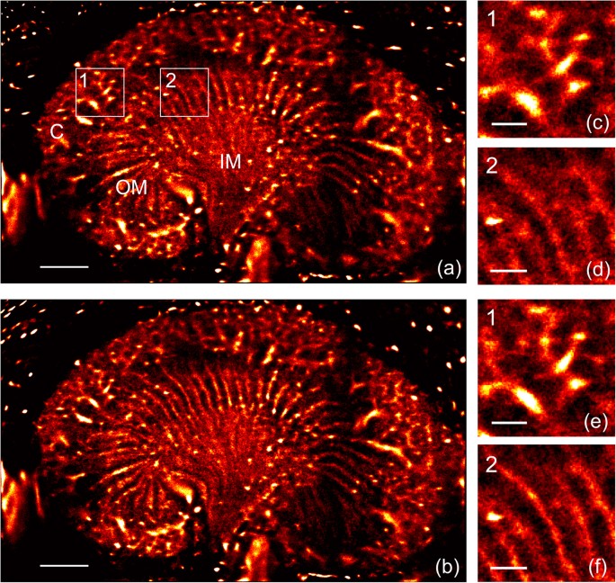 Ultrasound localization microscopy to image and assess microvasculature ...