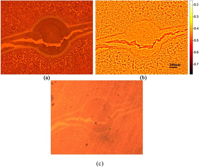 On-chip Microscopy Using Random Phase Mask Scheme | Scientific Reports