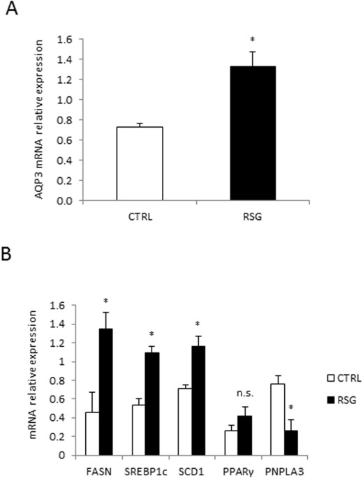 AQP3 is regulated by PPARγ and JNK in hepatic stellate cells carrying ...