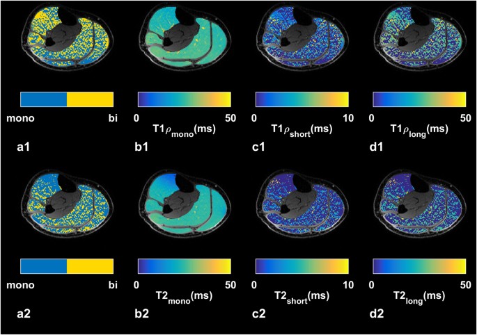 Bi-component T1ρ and T2 Relaxation Mapping of Skeletal Muscle In-Vivo | Scientific Reports