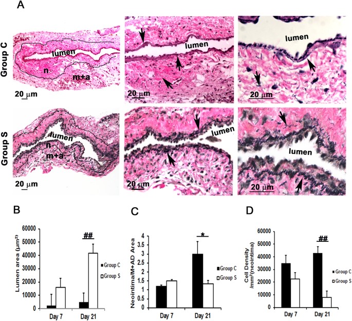 CorMatrix Wrapped Around the Adventitia of the Arteriovenous Fistula ...