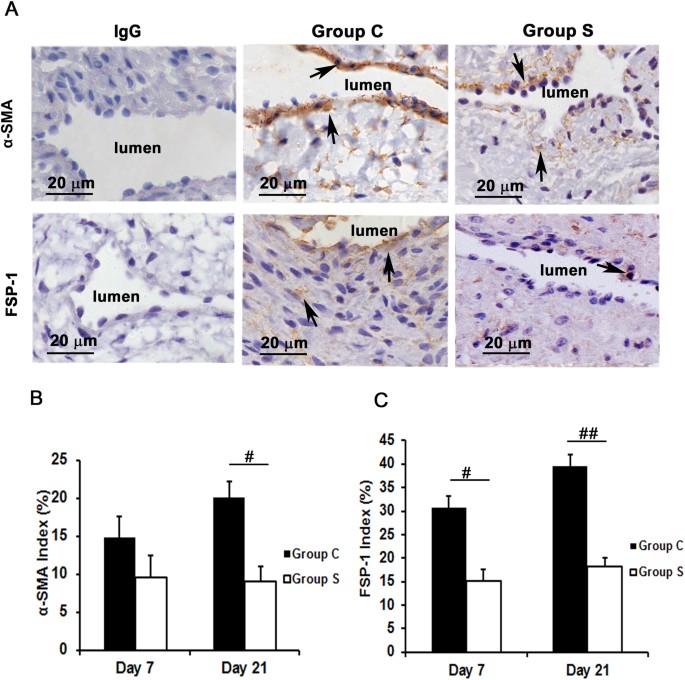 CorMatrix Wrapped Around the Adventitia of the Arteriovenous Fistula ...
