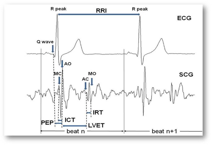 An algorithm for the beat-to-beat assessment of cardiac mechanics ...
